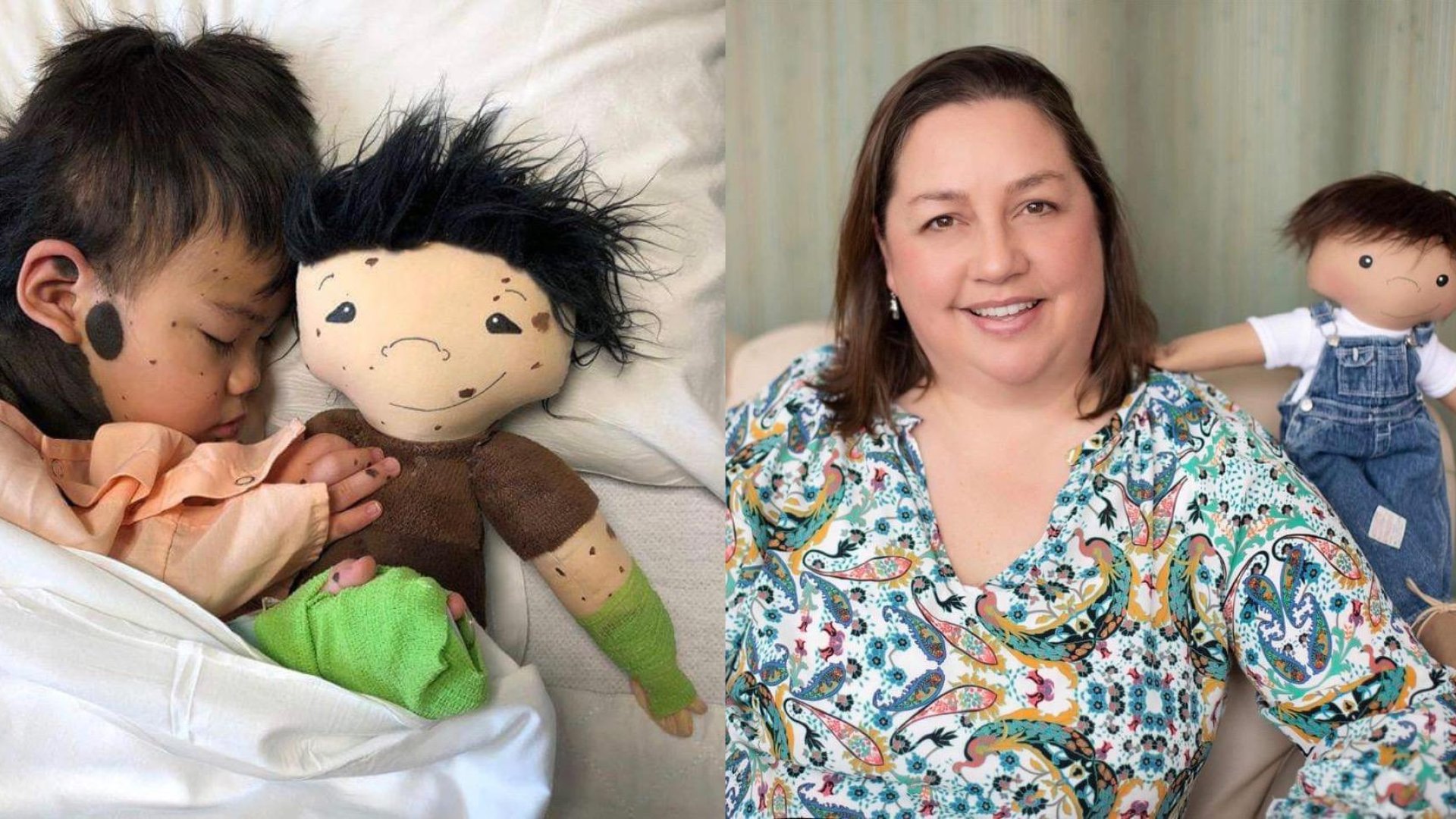 Celebrating Difference: Custom Dolls For Kids With Disabilities And ...