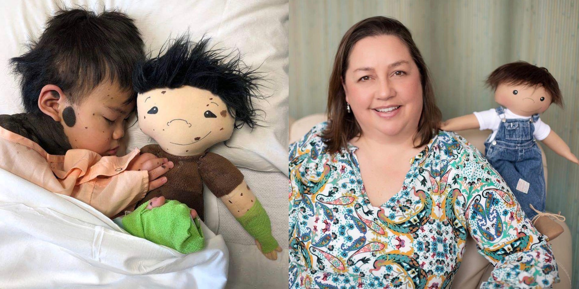 Celebrating Difference: Custom Dolls For Kids With Disabilities And ...
