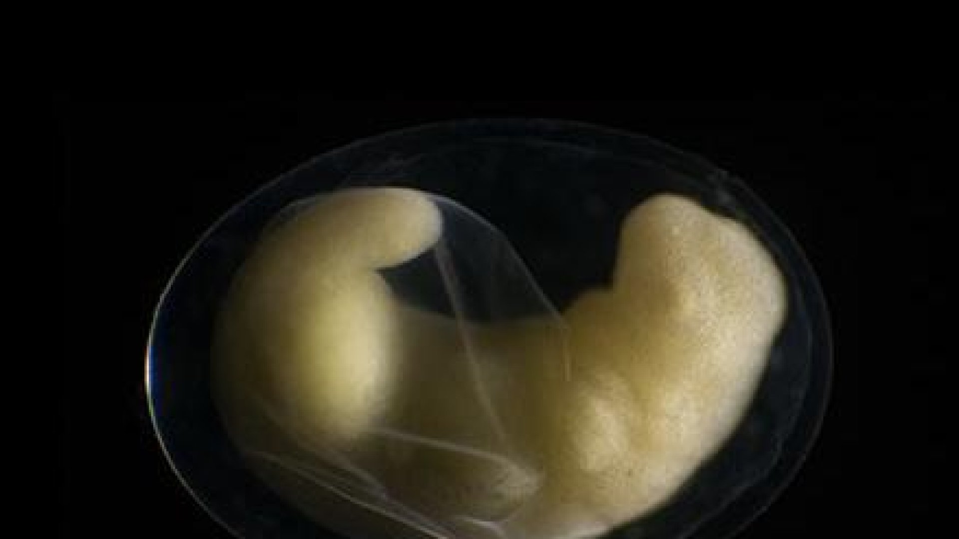 The miraculous genesis of animal life as a single cell becomes a ...